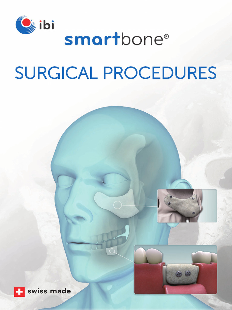 SmartBone Surgical Procedures | PDF | Surgical Suture | Bone