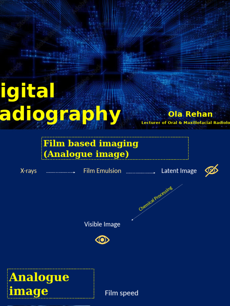 Digital Radiography Overview | PDF | Charge Coupled Device | Radiography
