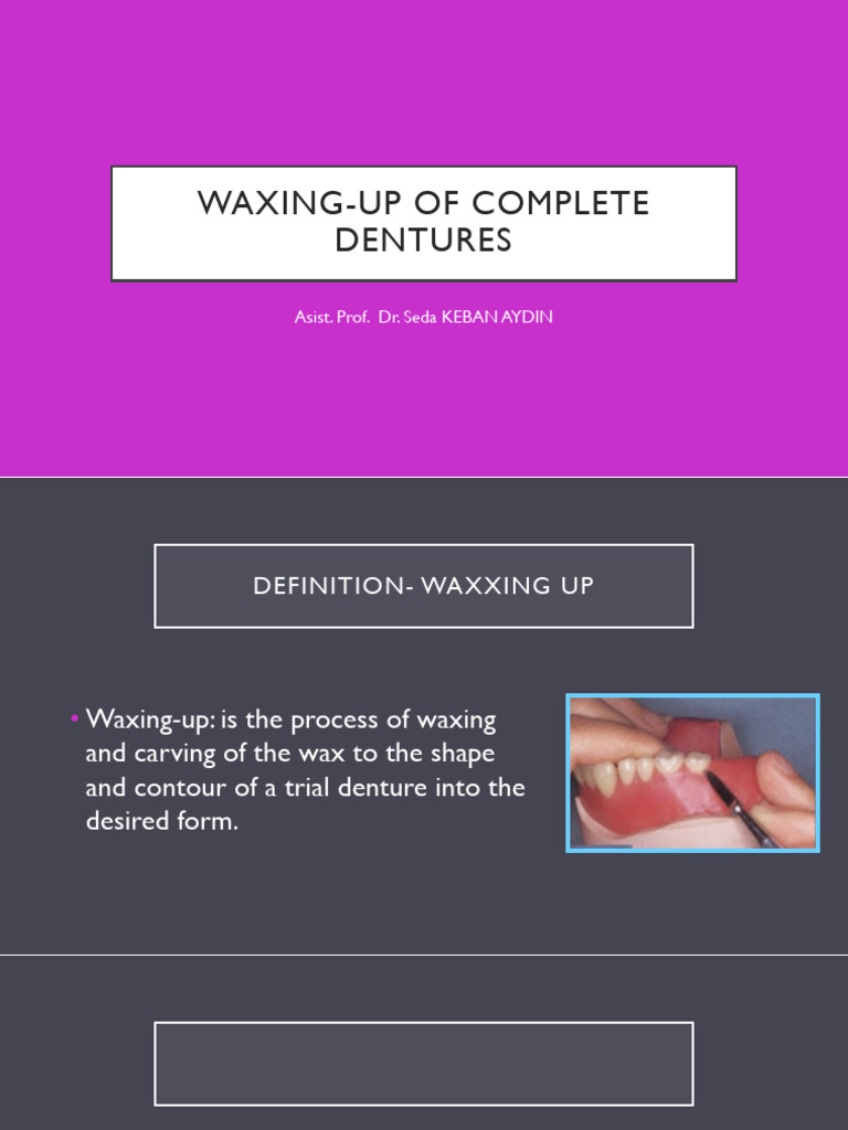 Waxing Up Complete Denture | PDF | Dentures | Dentistry