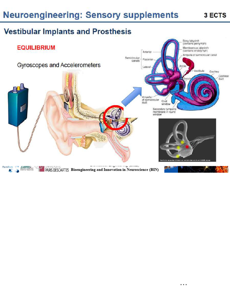 04 implants vestibulaires 2024 | PDF | Vestibular System | Biomedical Engineering