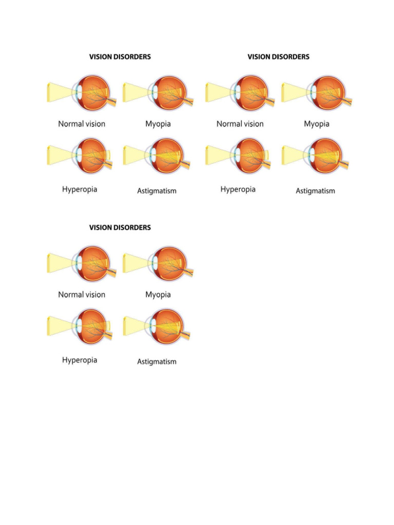Problemas Visuales | PDF