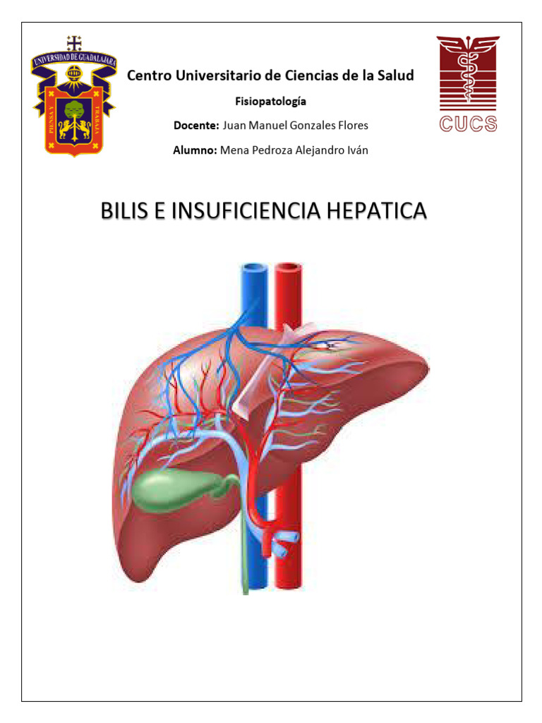 Billis e Insuficiencia Hepatica | PDF | Hepatitis | Bilis