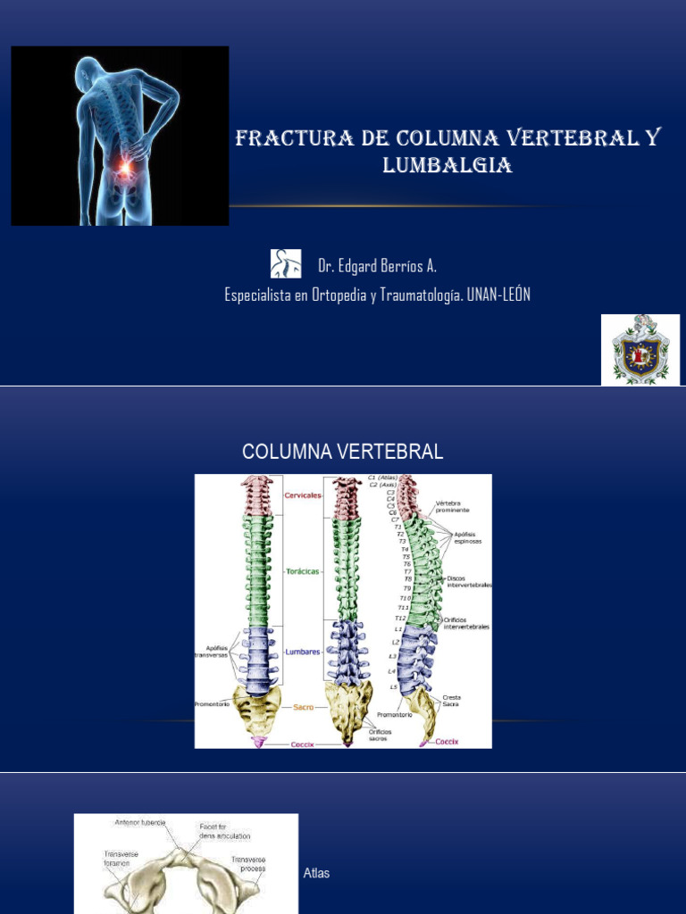 Fractura de Columna y Lumbalgia: Guía Clínica | PDF | Dolor lumbar | La ...