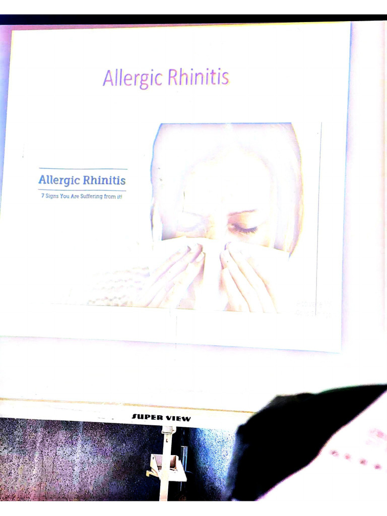Allergic Rhinitis | PDF