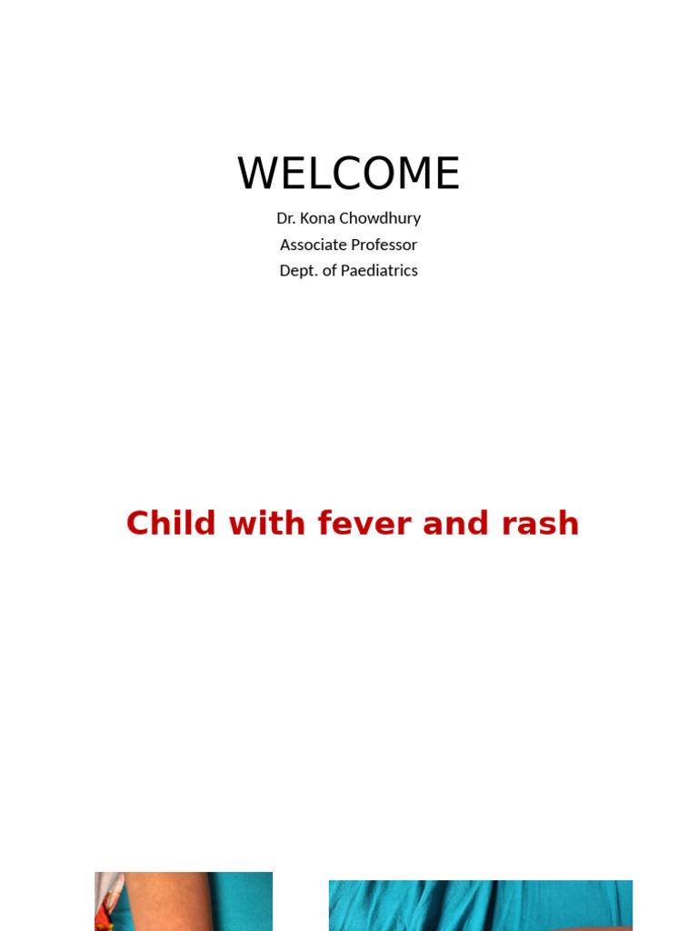 DD of skin rash | PDF