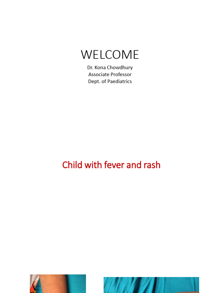 Fever N Rash | PDF