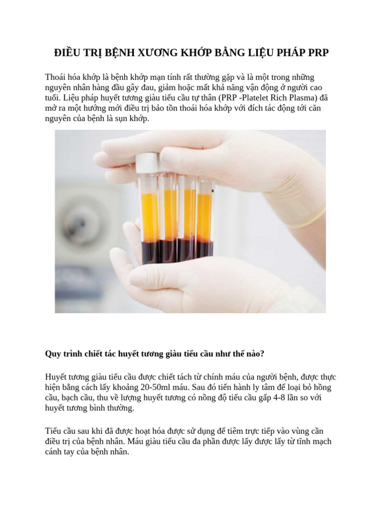 Điều Trị Bệnh Xương Khớp Bằng Liệu Pháp PRP | PDF