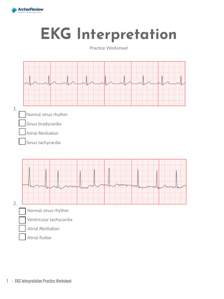 EKG Interpretation Practice Worksheet | PDF | Electrocardiography ...