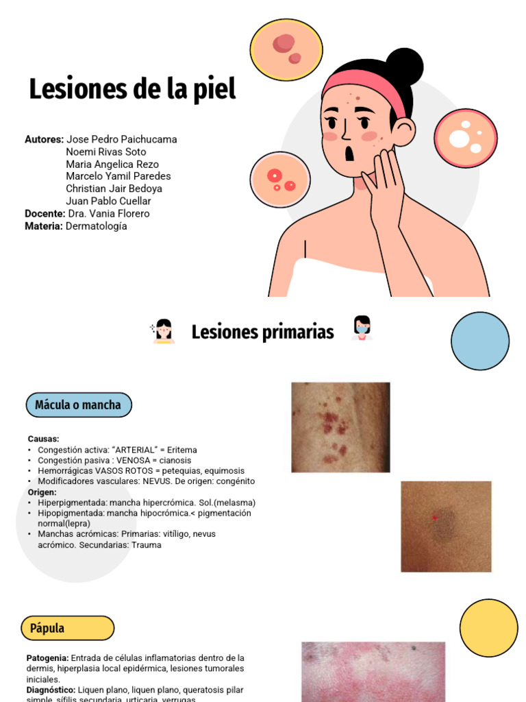 Clasificación y Diagnóstico de Lesiones Cutáneas | PDF | Dermatología ...