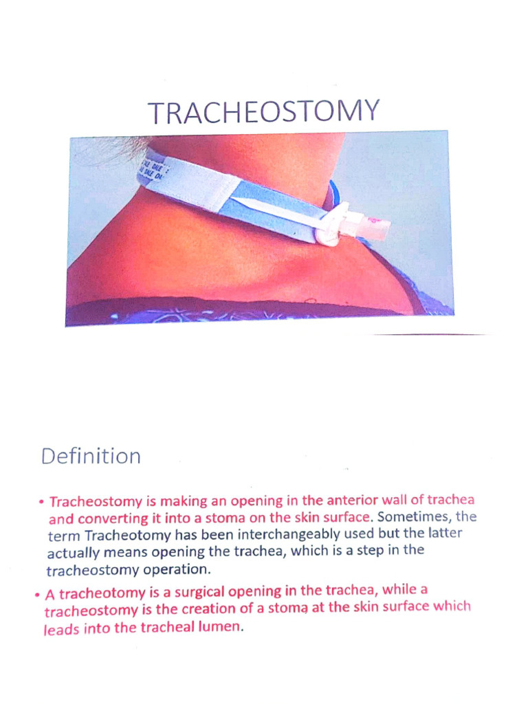 Tracheostomy | PDF