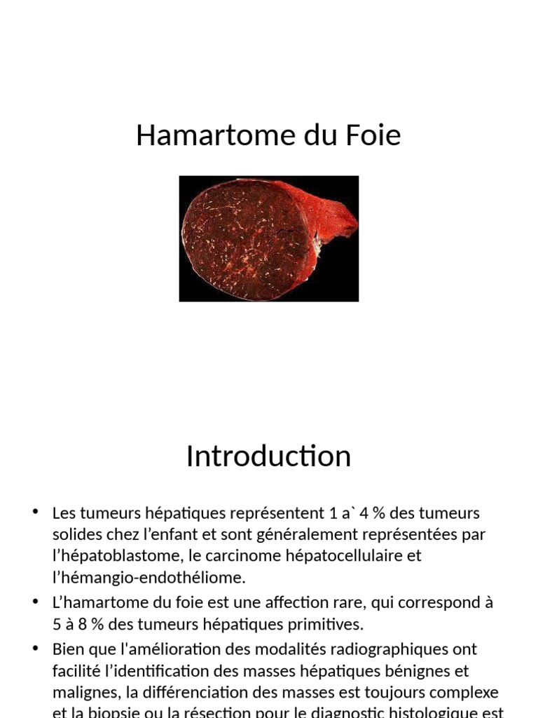 Hamartome du foie : diagnostic et traitement | PDF | Spécialités ...