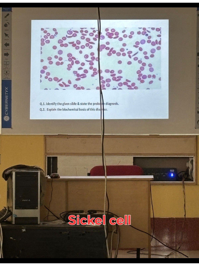 Biochemistry Case Study | PDF