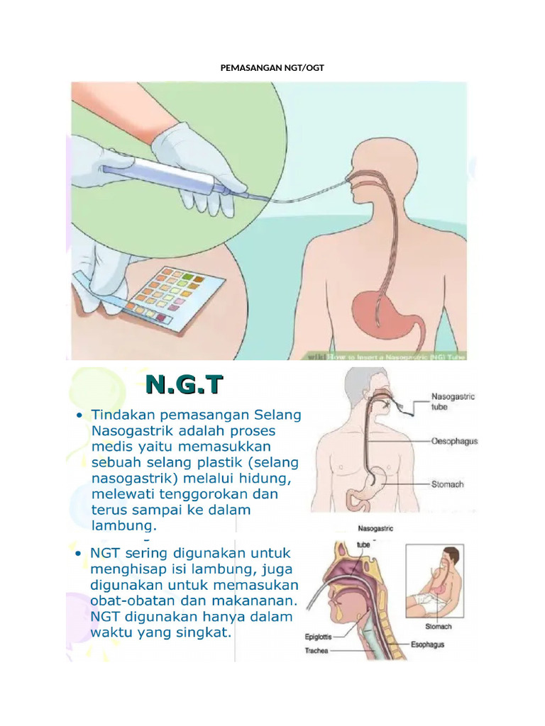 PEMASANGAN NGT | PDF