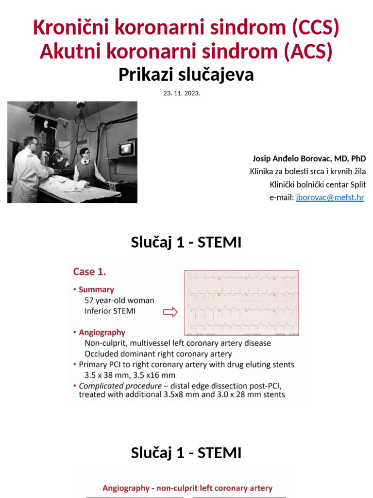 Prezentacija Interna CCS ACS 2023 | PDF