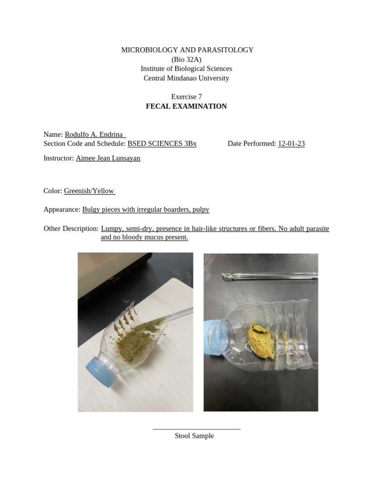 Exercise 7 FECAL EXAMINATION | PDF