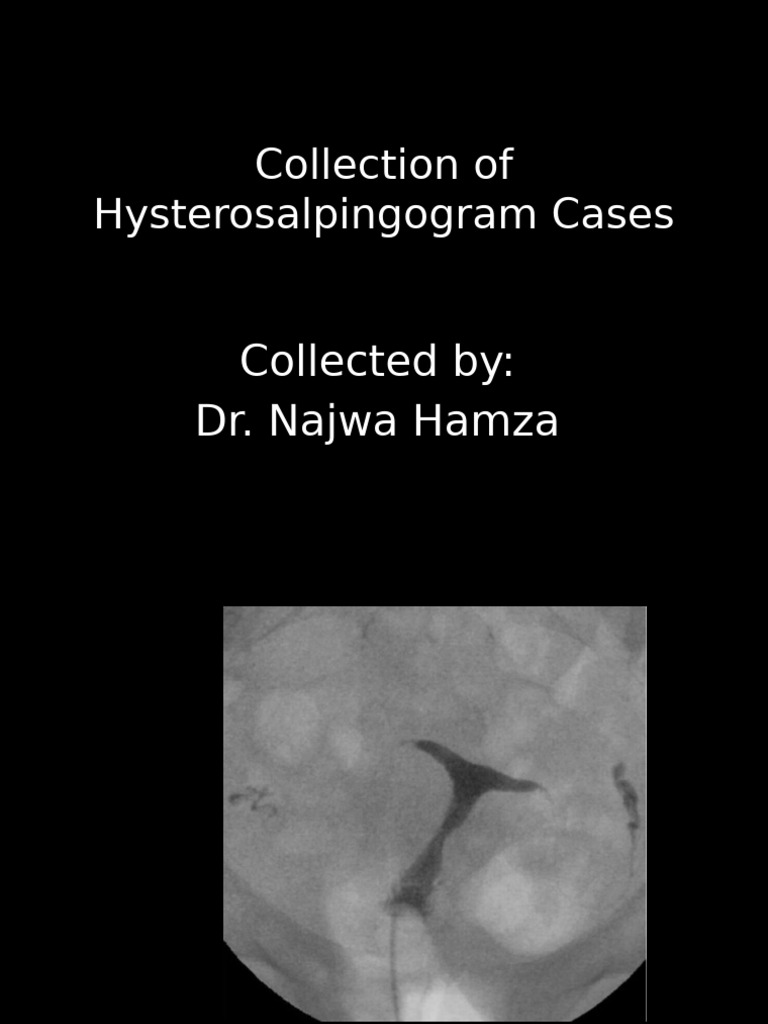 Hysterosalpingogram Case Studies | PDF | Uterus | Mammal Reproductive ...