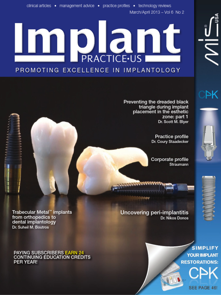 ImplantPractice Digital(0) | PDF | Dental Implant | Dental Degree