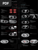 Azure XT DR Mri Surescan IFU | PDF | Artificial Cardiac Pacemaker ...