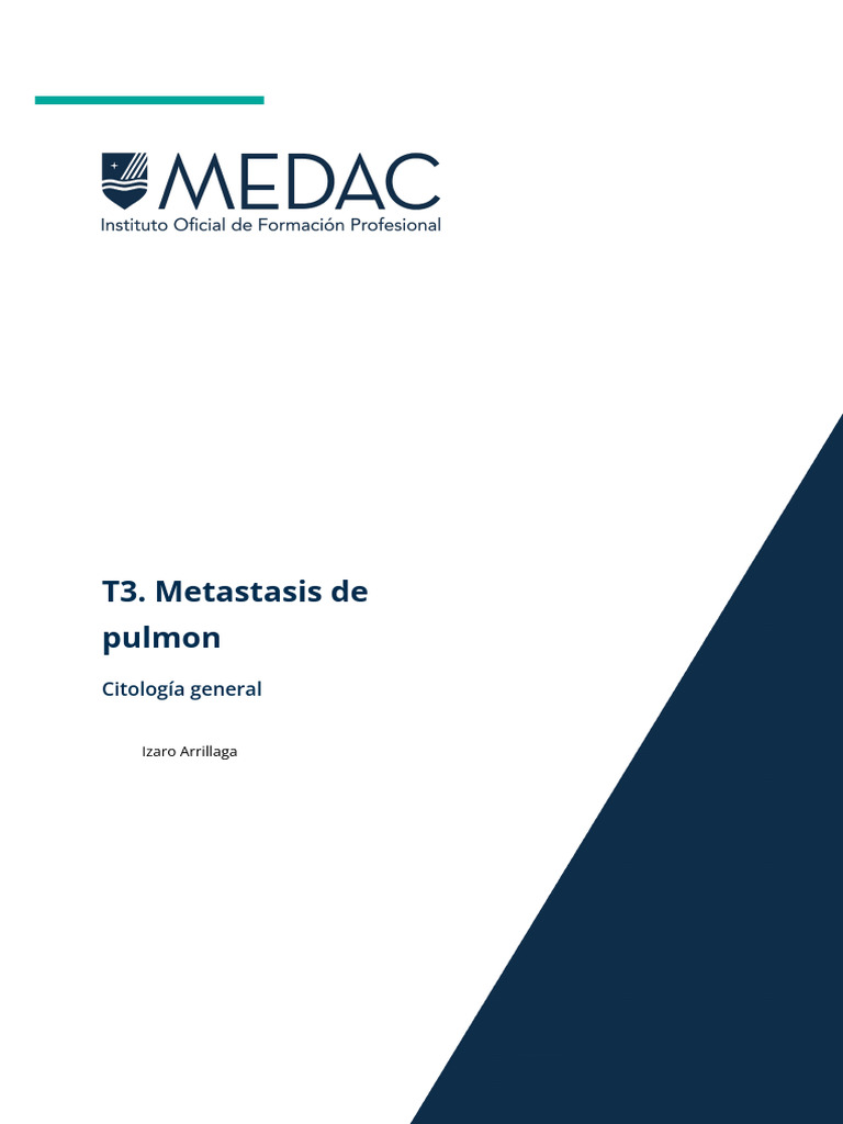 Metástasis Pulmonar: Importancia y Tratamiento | PDF | Metástasis | Cáncer