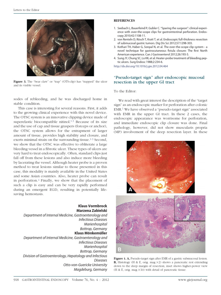 #x201c Pseudo Target Sign” After Endoscopi | PDF | Gastroenterology ...
