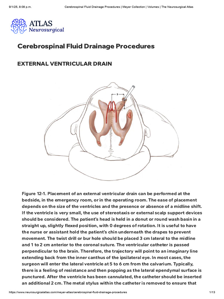 Cerebrospinal Fluid Drainage Procedures - Meyer Collection - Volumes ...