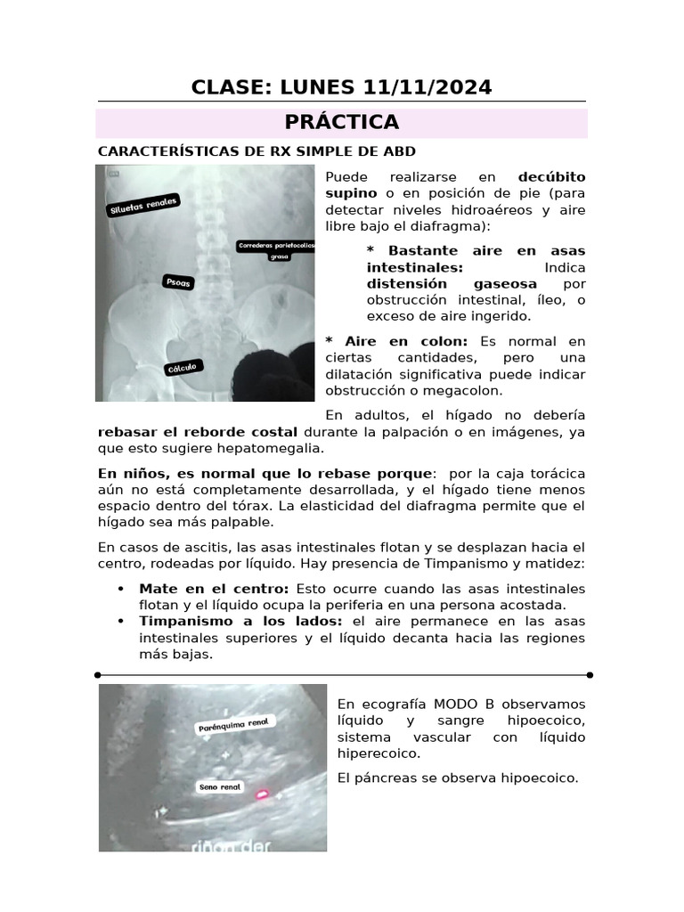 Características de RX y TAC Abdominales | PDF | Hígado | Abdomen