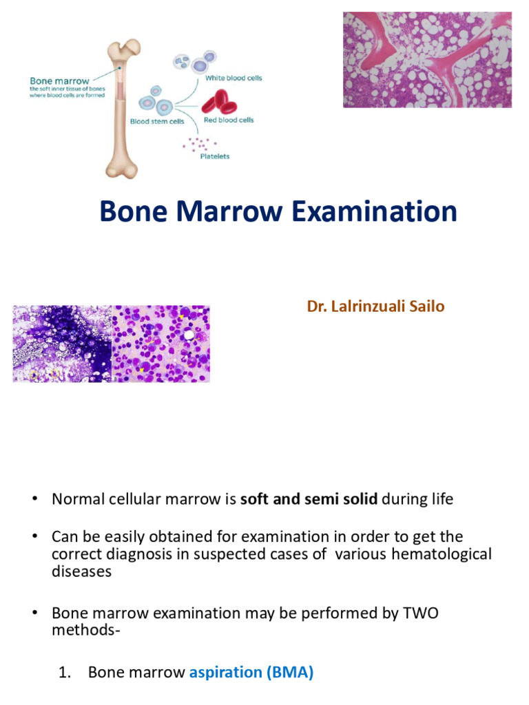 Bone Marrow Examination Overview | PDF | Bone Marrow | Anemia