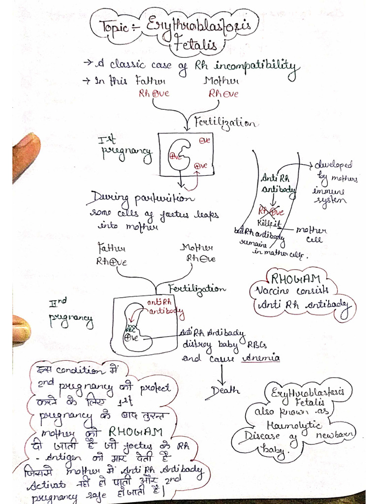 Erythroblastosis fetalis | PDF