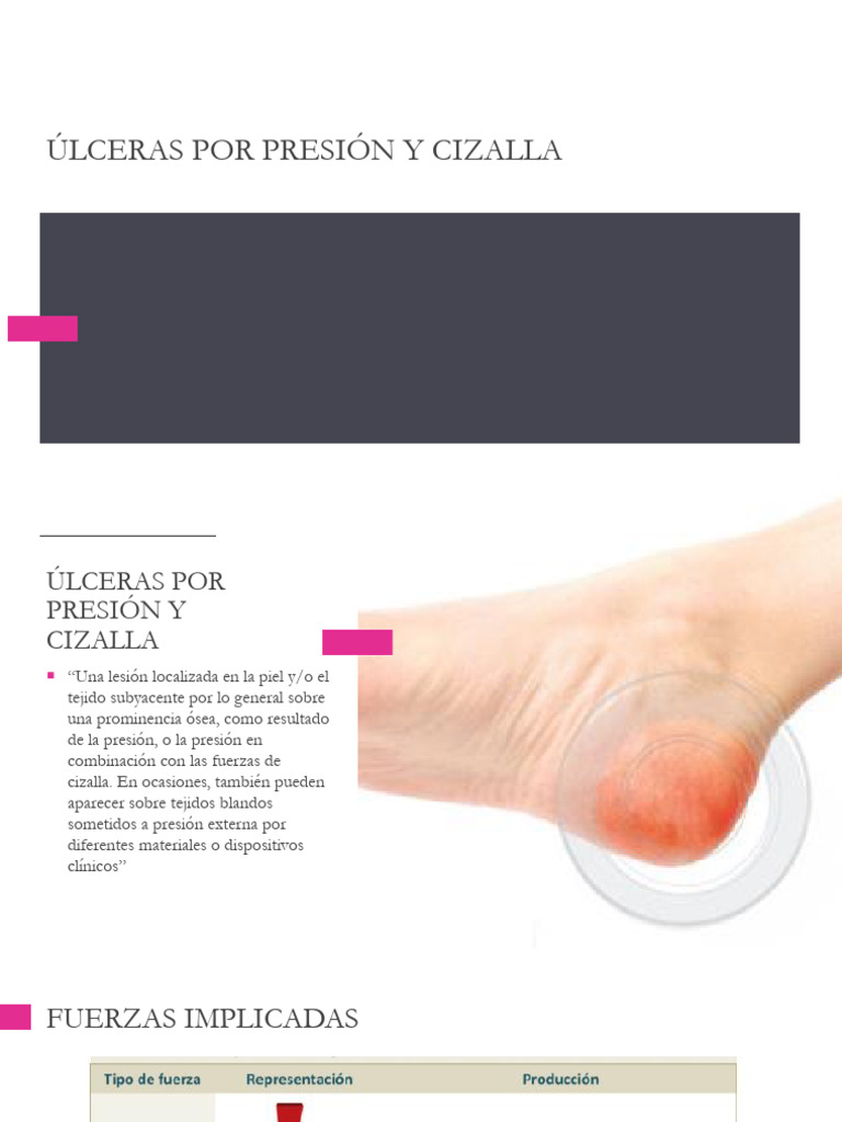 Úlceras Por Presión y Cizalla | PDF | Piel | Herida