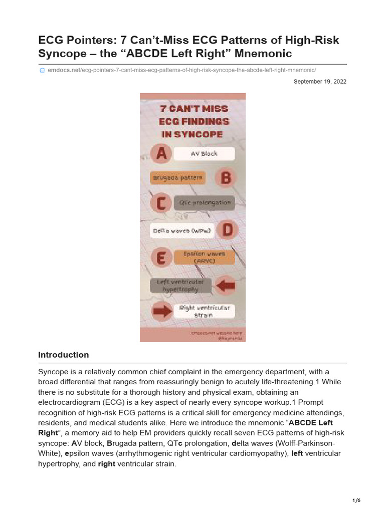 ECG Pointers 7 Cant-Miss ECG Patterns of High-Risk Syncope The ABCDE ...