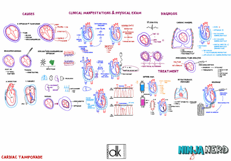 Cardiac Tamponade (1) | PDF