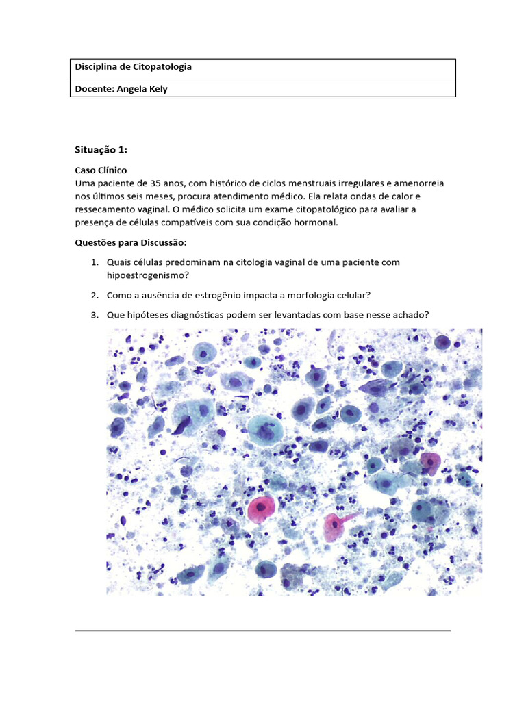 Atividade 20 Endocrinologia 20 Ginecol C3 B3 Gica | PDF | Ciclo ...