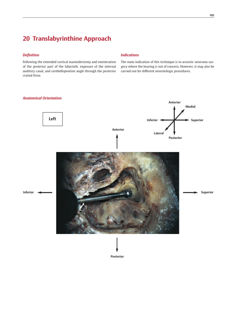 Aproach Translabirintica | PDF | Auditory System | Sensory Organs