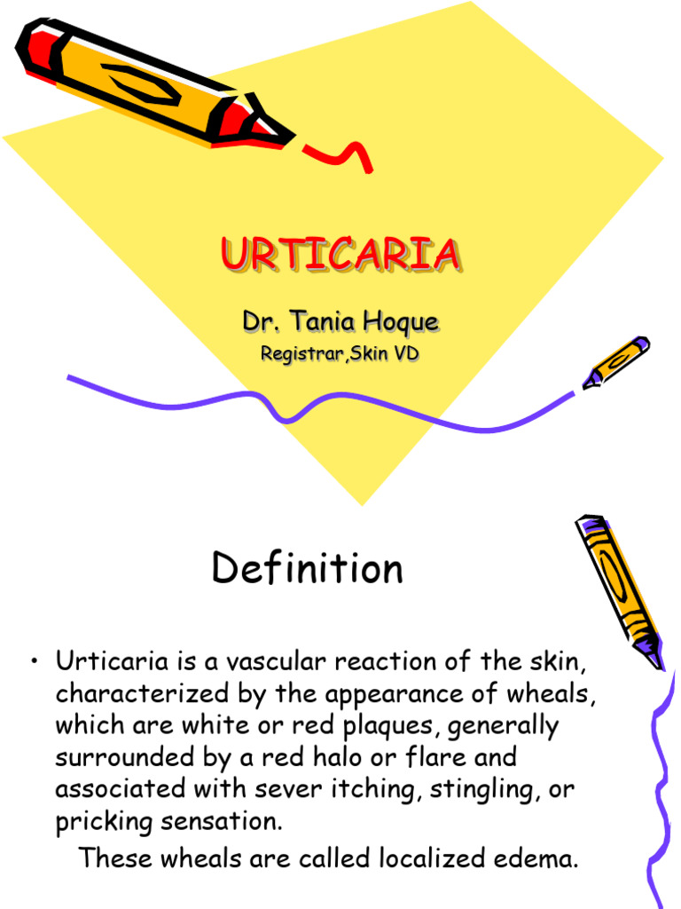 Urticaria | PDF