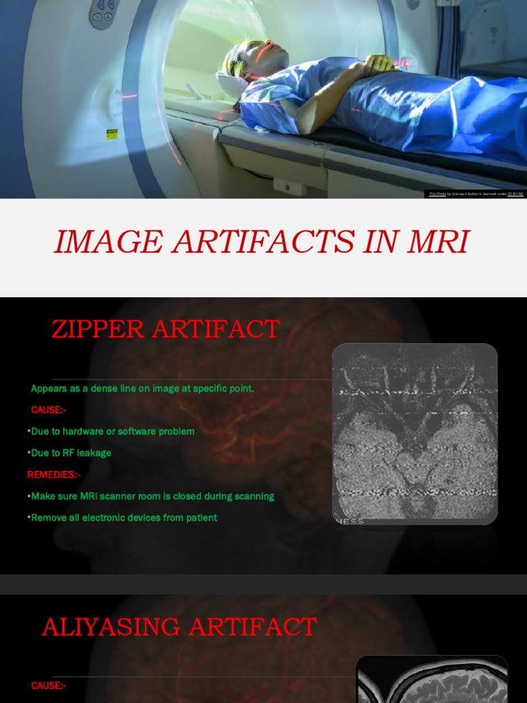 MRI Image Artifacts 1736549503 | PDF