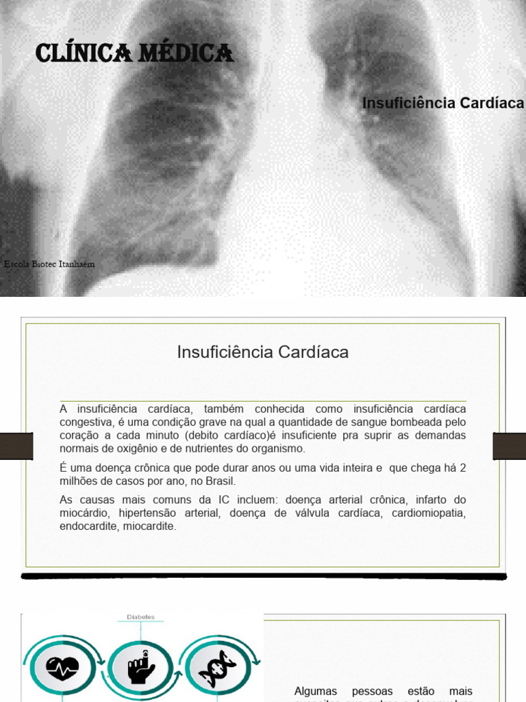 Cl-nica M-dica- ICC e IAM | PDF | Infarto do Miocárdio | Insuficiência cardíaca