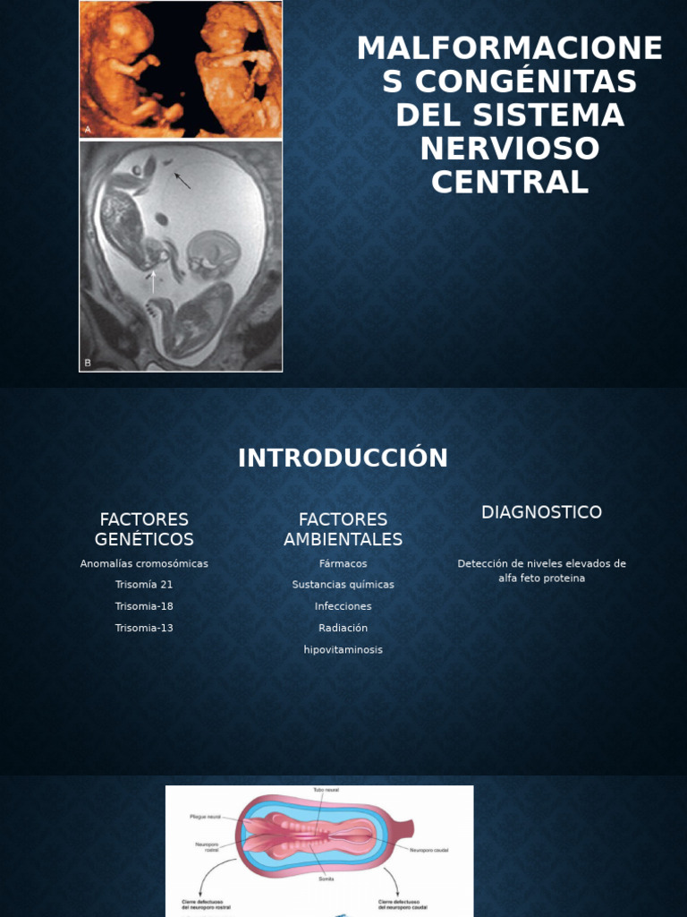 Malformaciones SNC 25 | PDF | Fluido cerebroespinal | Cerebro