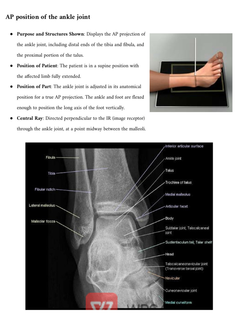 Ankle and Foot X-Ray Positioning Guide | PDF | Ankle | Foot