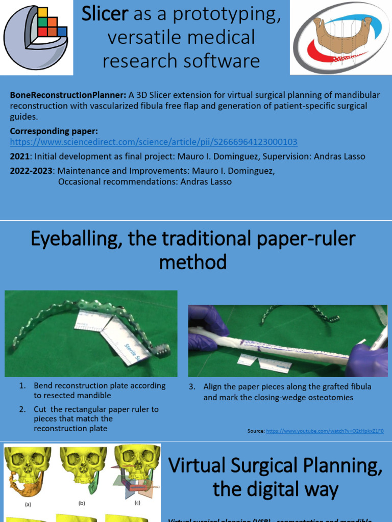 Bone Reconstruction Planner Slides | PDF | 3 D Printing