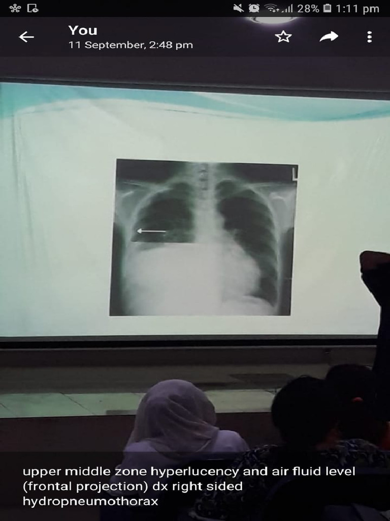 Class X-Rays | PDF
