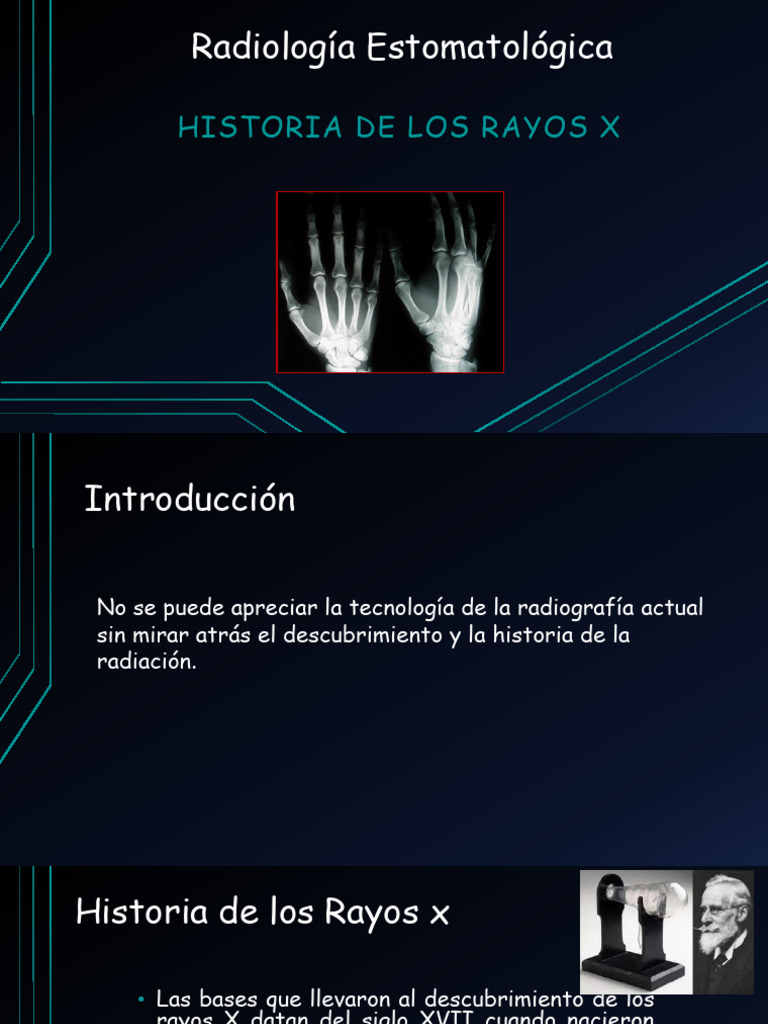 Historia de los rayos X presentacion | PDF | Rayo X | Relámpago