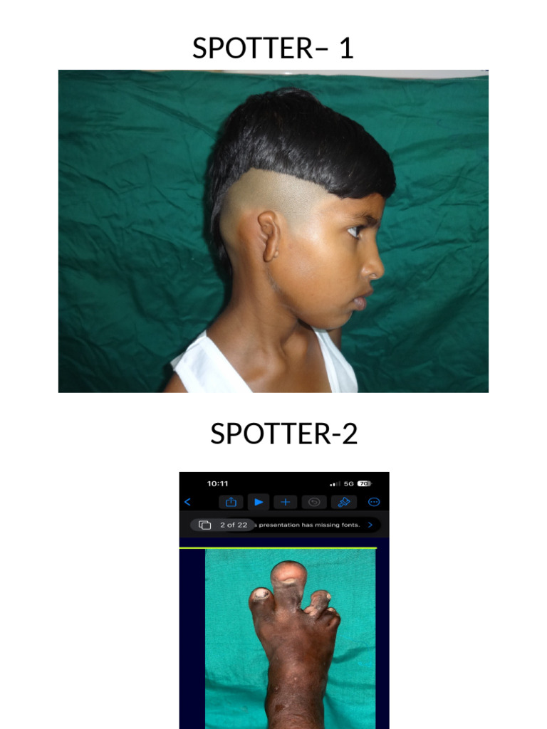 Spotter 1 3 | PDF