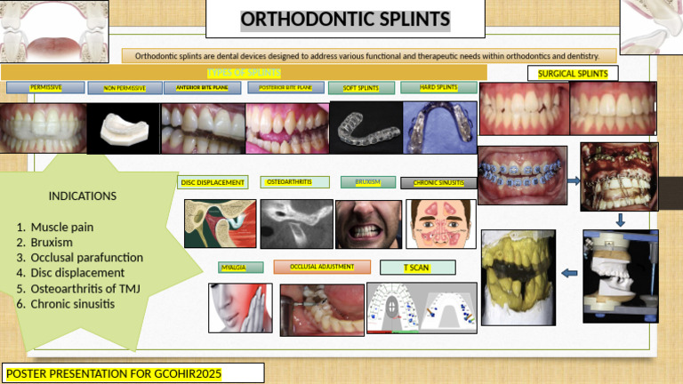 Final Splint Poster | PDF