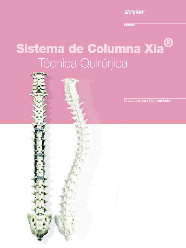 XIA Soluciones para Deformidades (Esp) | PDF | Tornillo | Hueso