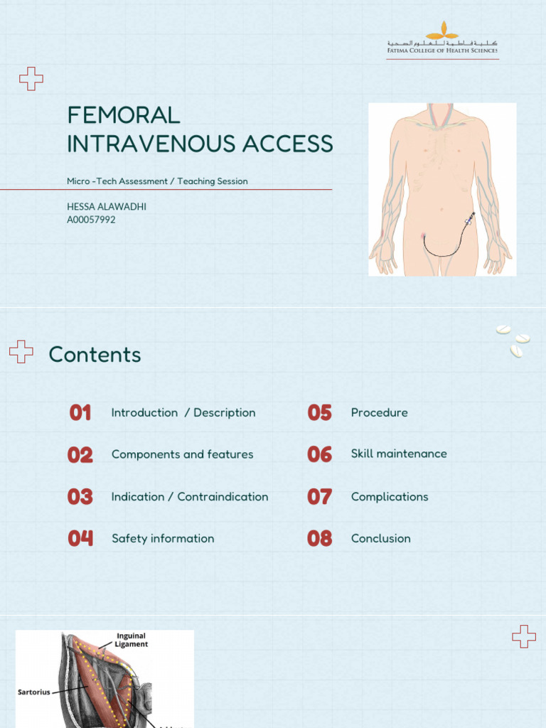 Femoral Vein IV Access Procedure Guide | PDF | Intravenous Therapy | Vein