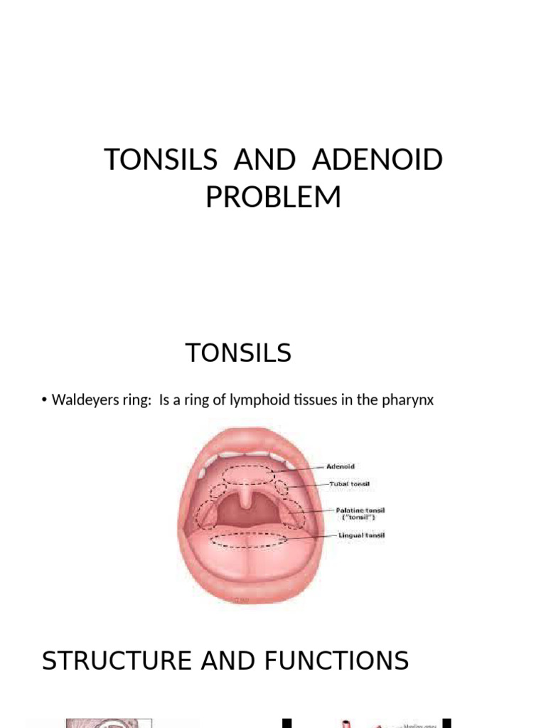 Tonsils and Adenoid Problem | PDF | Medical Specialties | Diseases And Disorders