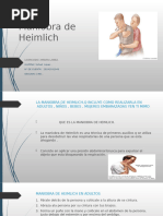 Maniobra de Heimlich en Mujeres Embarazadas | PDF