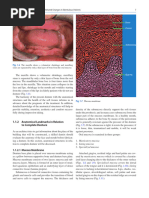 Maxillary Anatomical Landmarks | PDF | Dentures | Lip