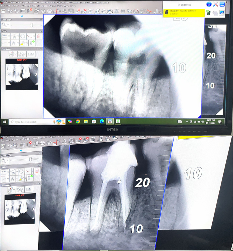 MR - Vinod Gupta IOPA | PDF