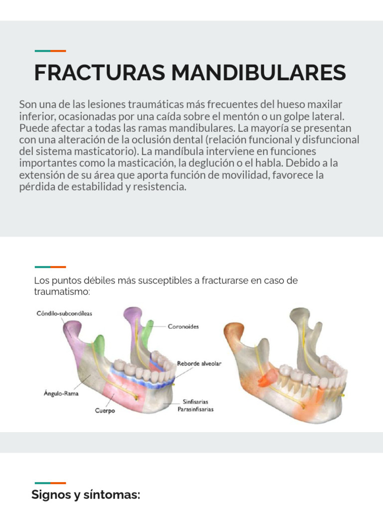 Fracturas Mandibulares y Cigomáticas | PDF | Anatomía humana ...